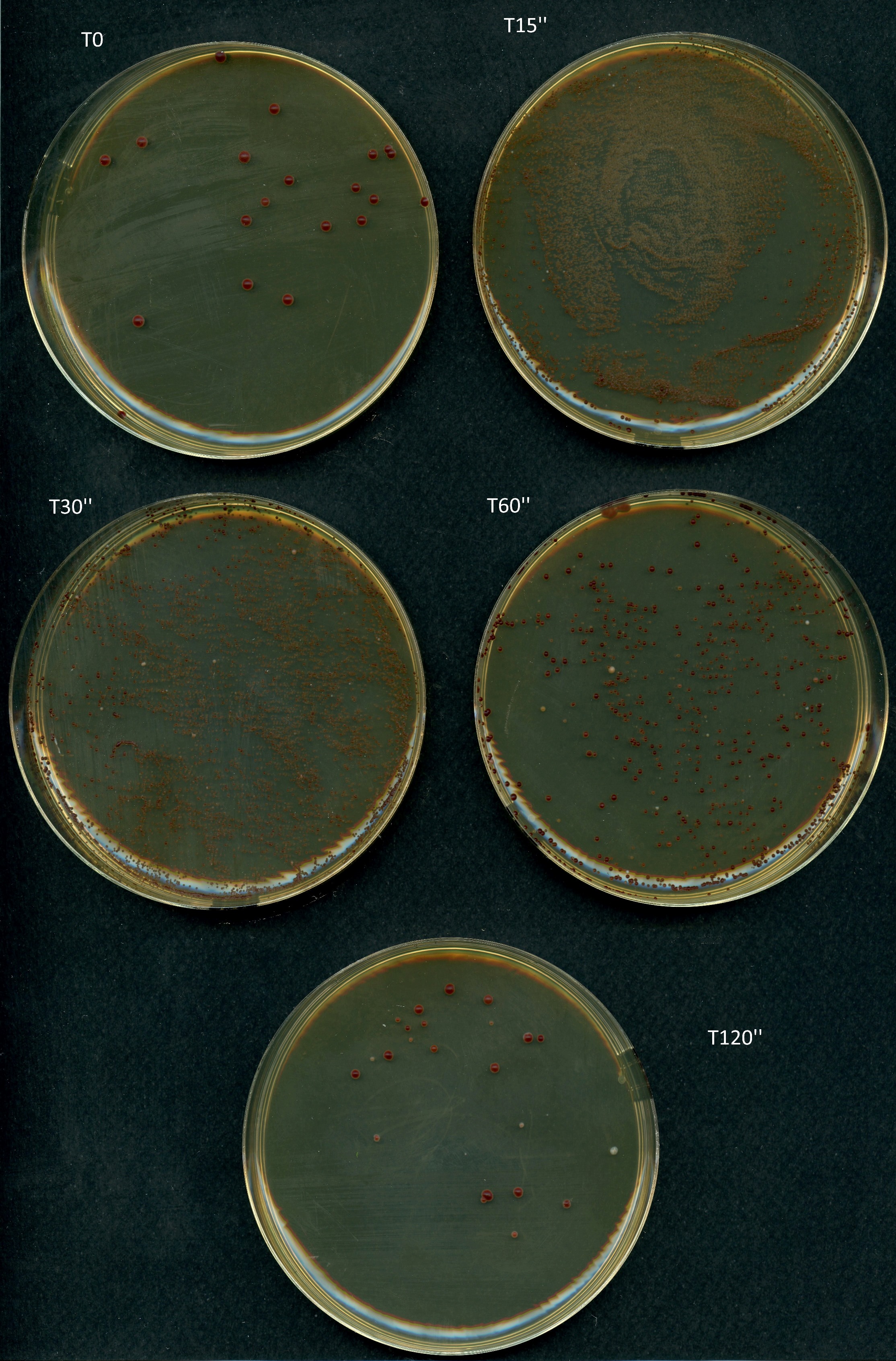 mutation des levures ade2 UV - Forum National de SVT